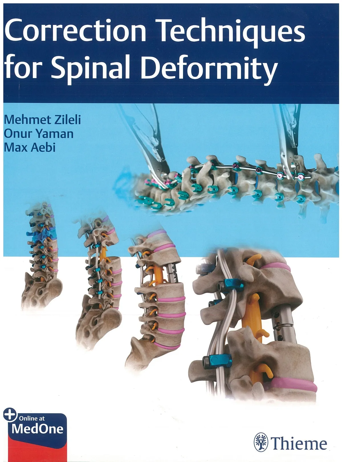 *Correction Techniques for Spinal Deformity
