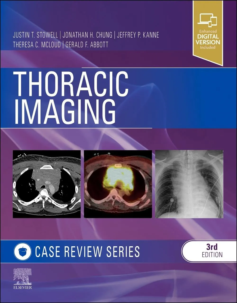 Thoracic Imaging: Case Review Series