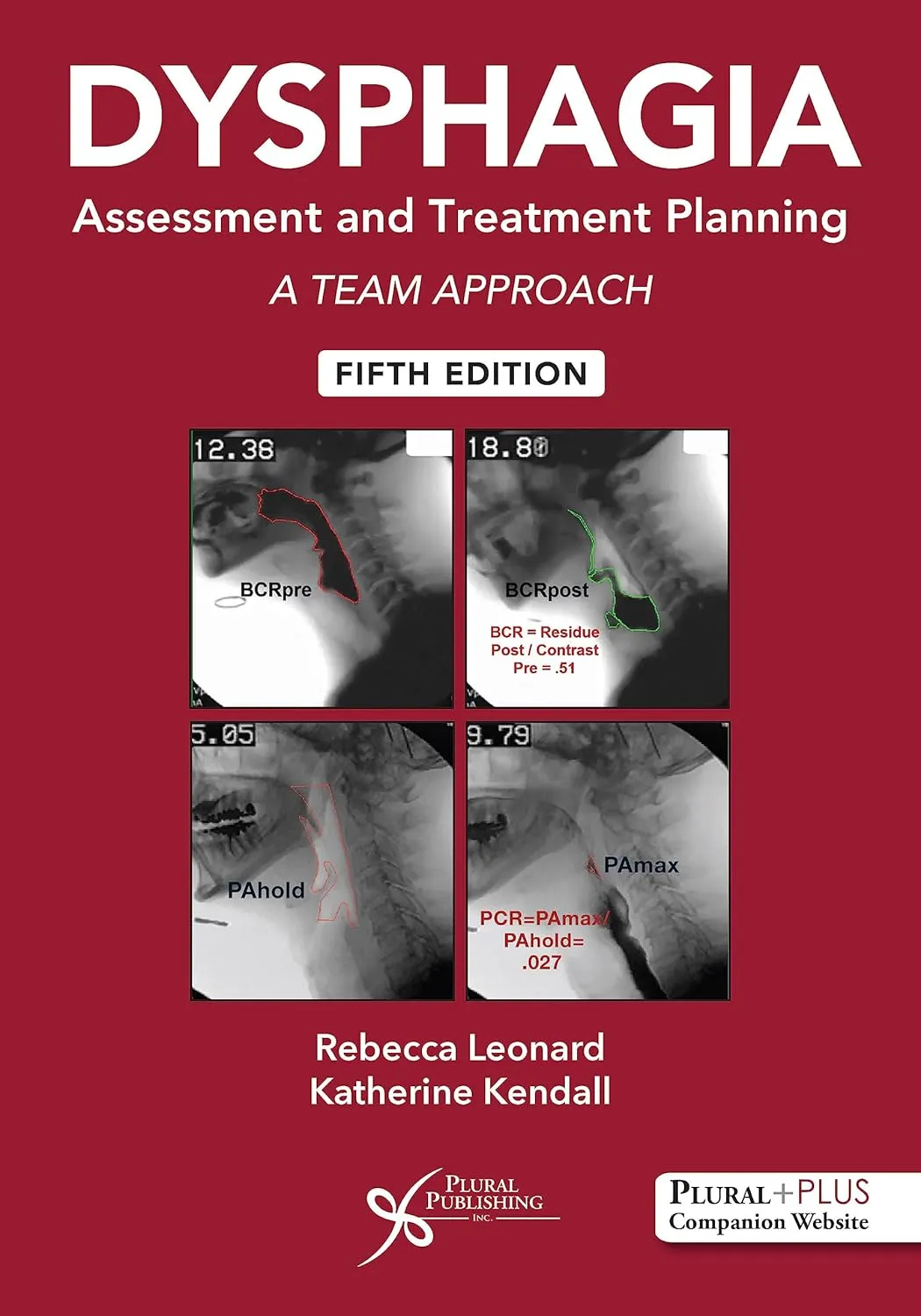 Dysphagia Assessment and Treatment Planning: A Team Approach