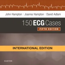 (舊版特價-恕不退換)150 ECG Cases (IE)