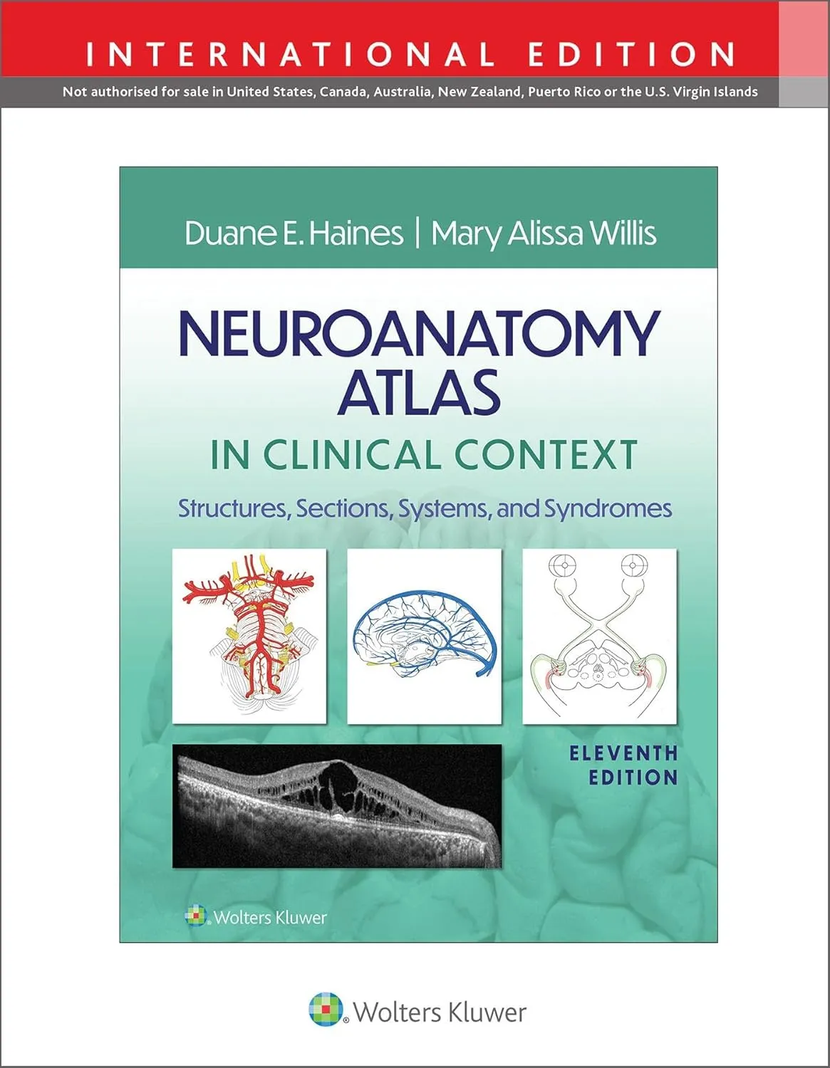 Neuroanatomy Atlas in Clinical Context:Structures, Sections, Systems ...