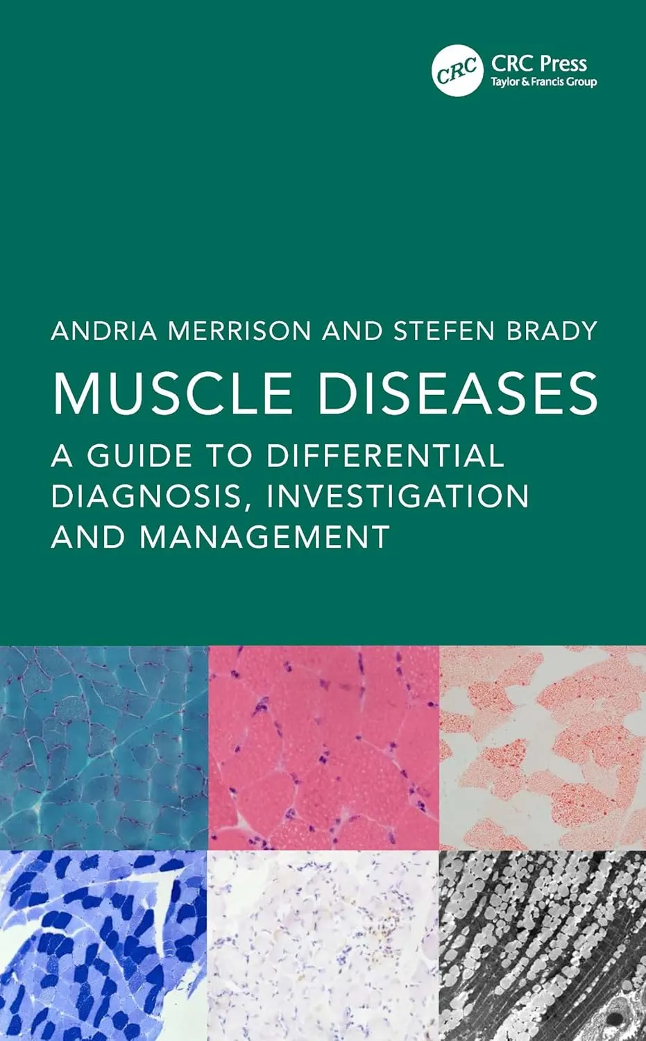 Muscle Diseases: A Guide to Differential Diagnosis, Investigation and ...