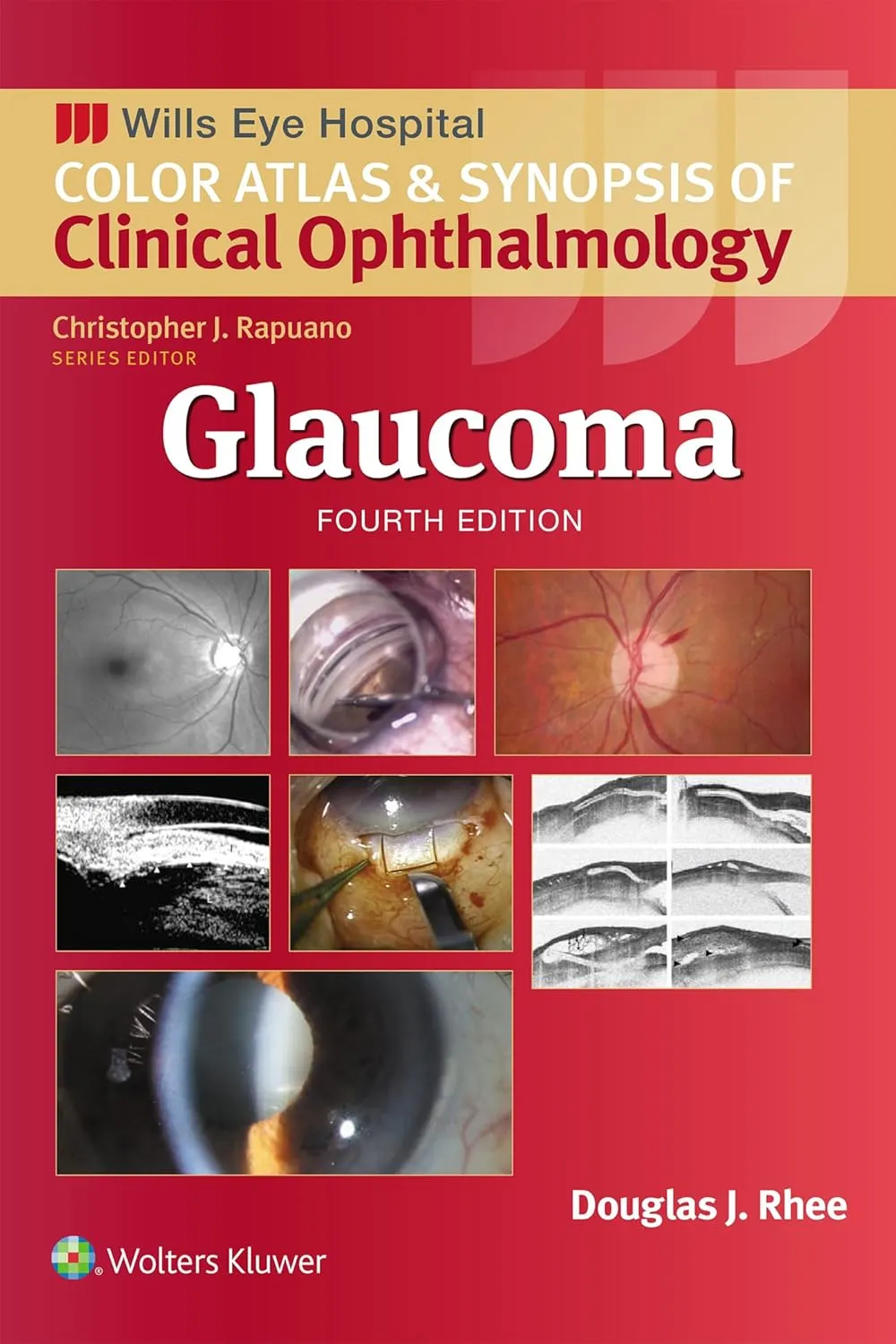 Color Atlas & Synopsis of Clinical Ophthalmology: Glaucoma