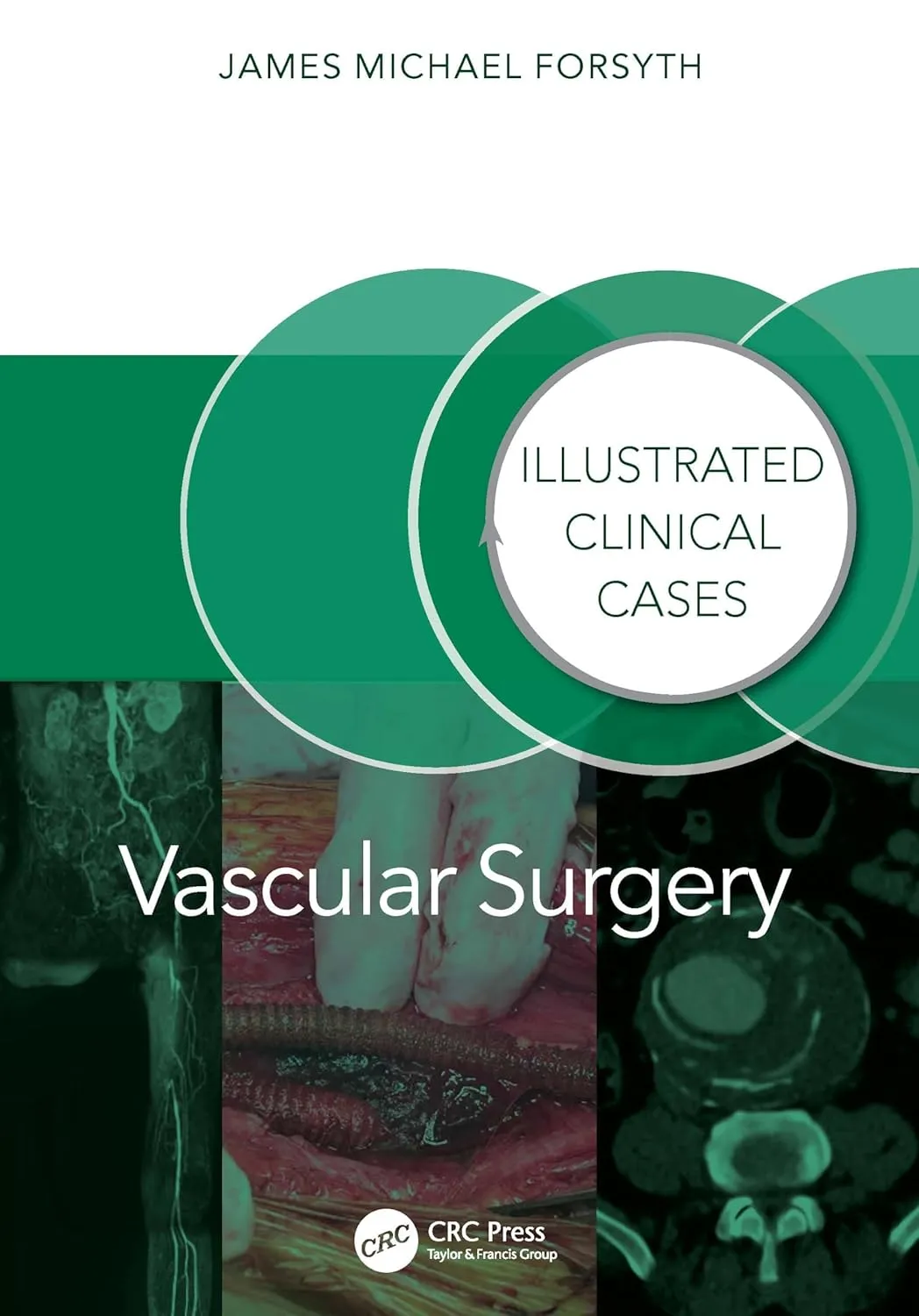 Vascular Surgery (Illustrated Clinical Cases)
