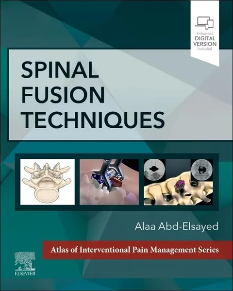 Atlas of Interventional Pain Management: Spinal Fusion Techniques