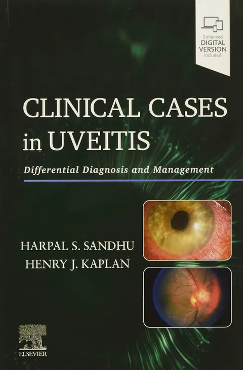 Clinical Cases in Uveitis: Differential Diagnosis and Management