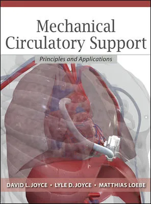 Mechanical Circulatory Support:Principles and Applications