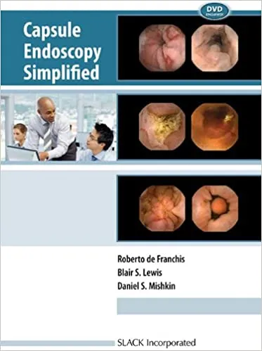 Capsule Endoscopy Simplified with DVD