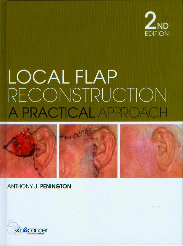 (舊版特價-恕不退換)Local Flap Reconstruction: A Practical Approach