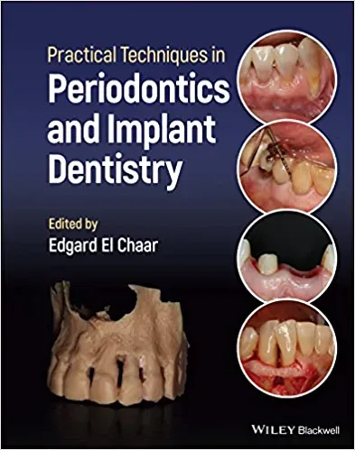 Practical Techniques in Periodontics and Implant Dentistry