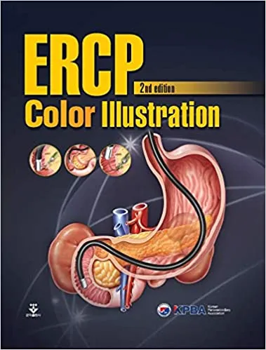 ERCP Color Illustration