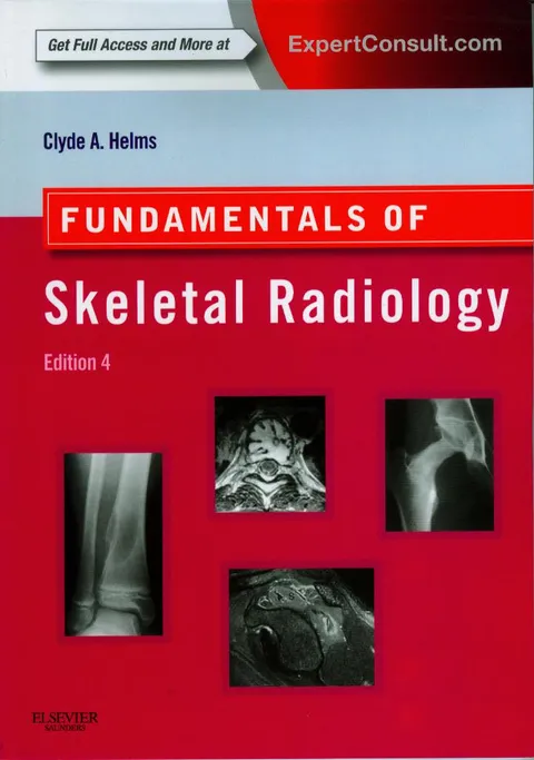 (舊版特價-恕不退換)Fundamentals of Skeletal Radiology: Expert Consult: Online ...