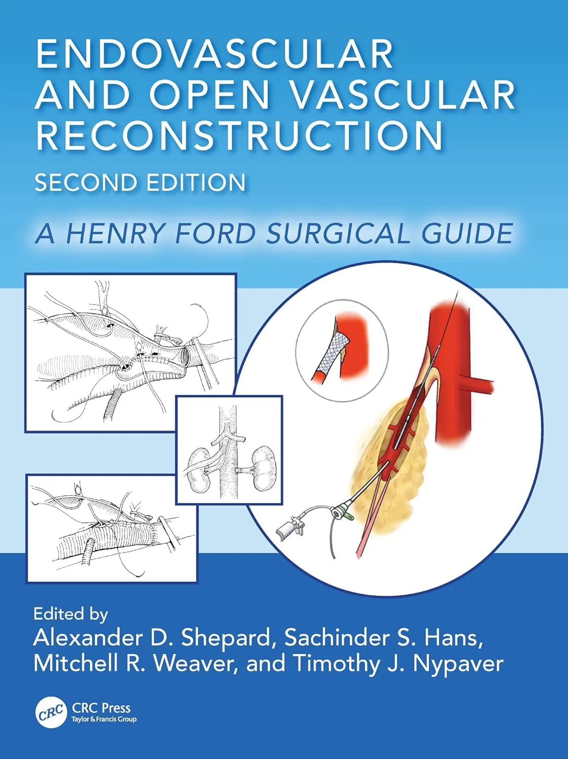Endovascular and Open Vascular Reconstruction: A Henry Ford Surgical Guide