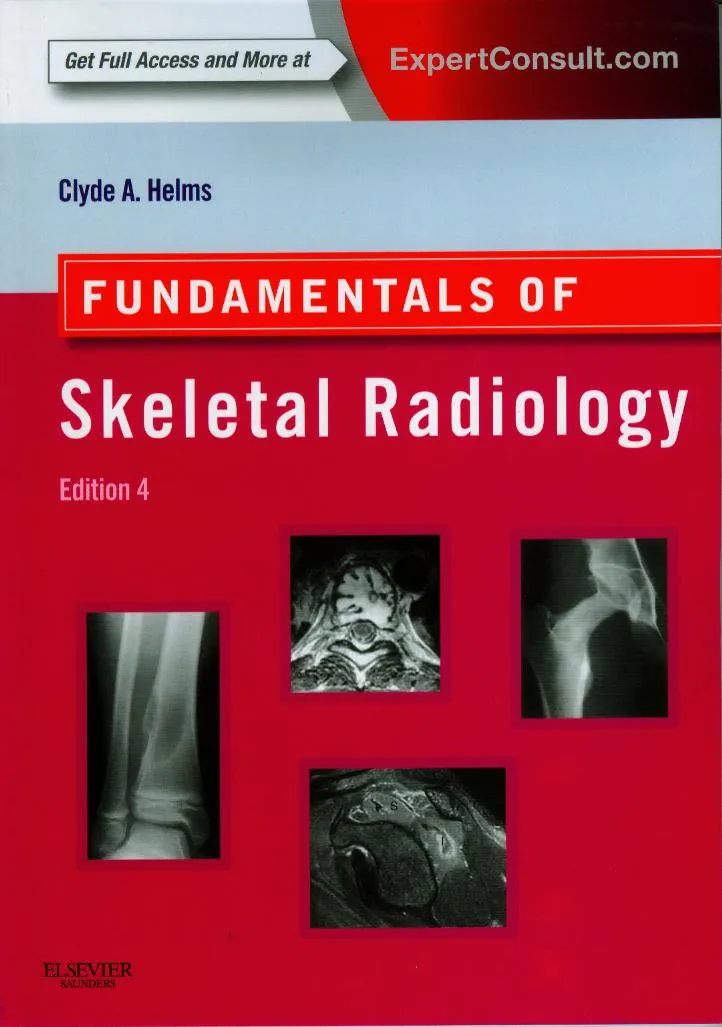 (舊版特價-恕不退換)Fundamentals of Skeletal Radiology: Expert Consult: Online ...