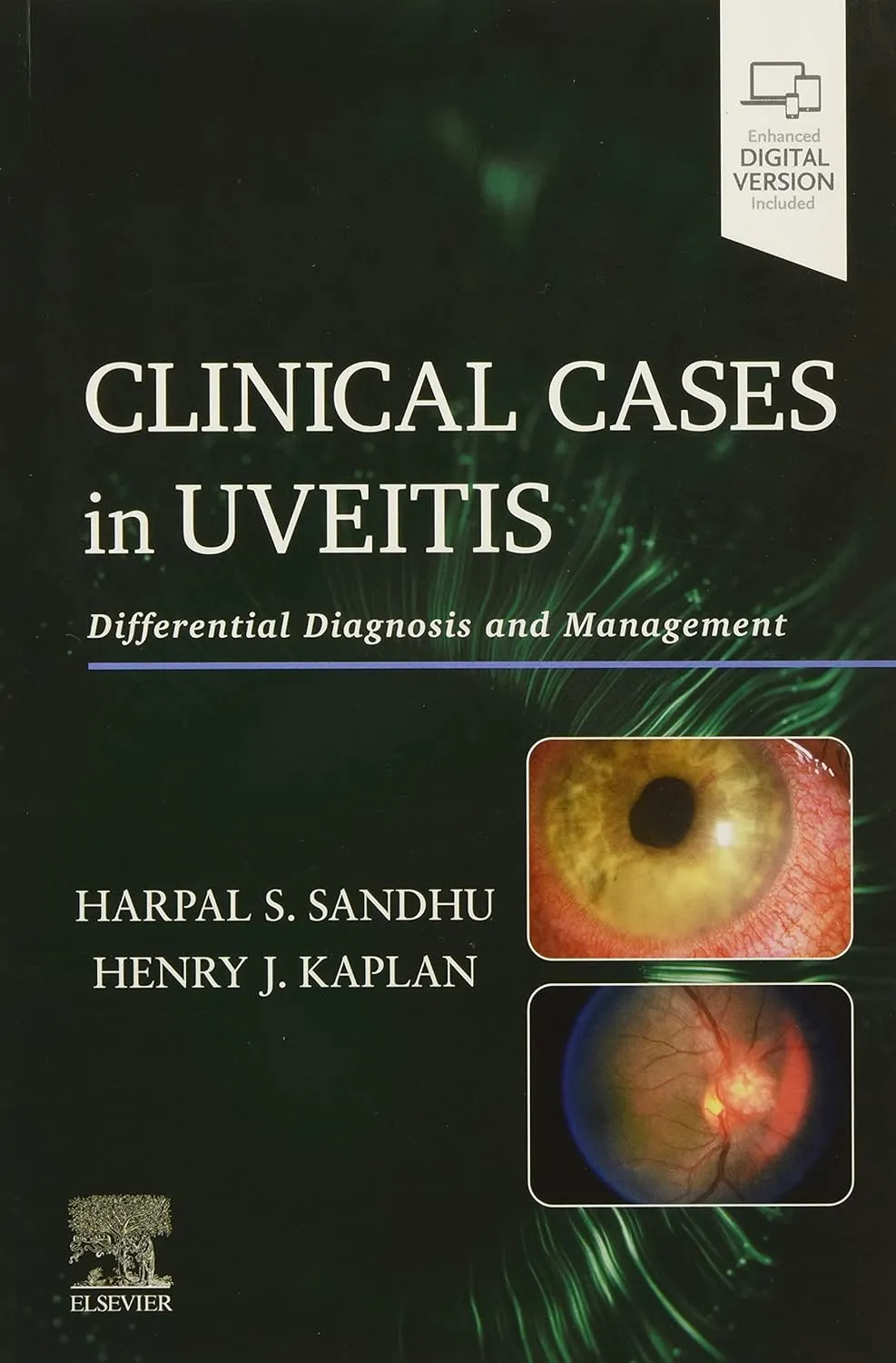 Clinical Cases in Uveitis: Differential Diagnosis and Management