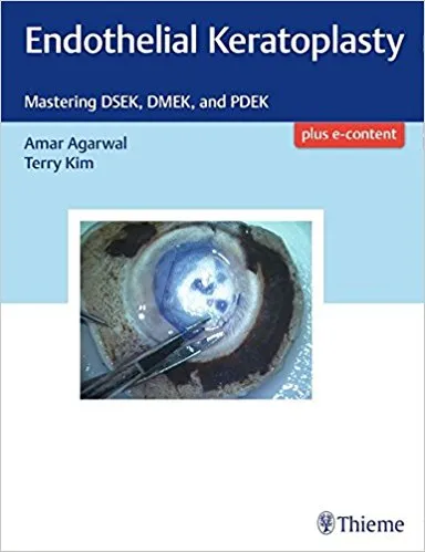 Endothelial Keratoplasty: Mastering DSEK, DMEK, and PDEK