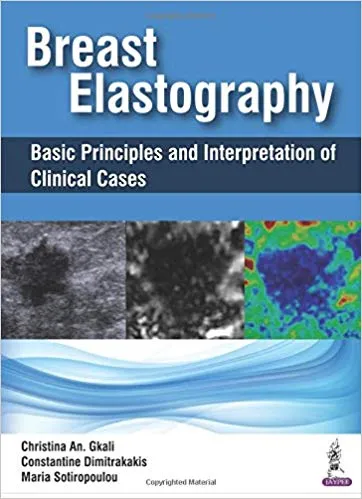 Breast Elastography: Basic Principles and Interpretation of Clinical Cases