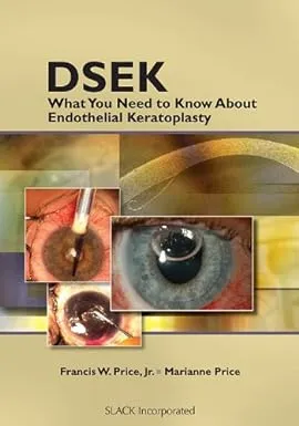 DSEK: What You Need to Know about Endothelial Keratoplasty WITH DVD-ROM